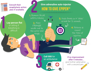 How to use Epipen® - Anaphylaxis First Aid
